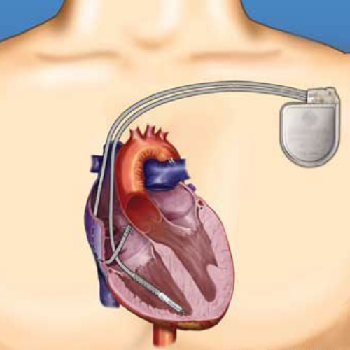 Cardiac Treatments - best heart specialist | Heart Rhythm Clinic Raipur